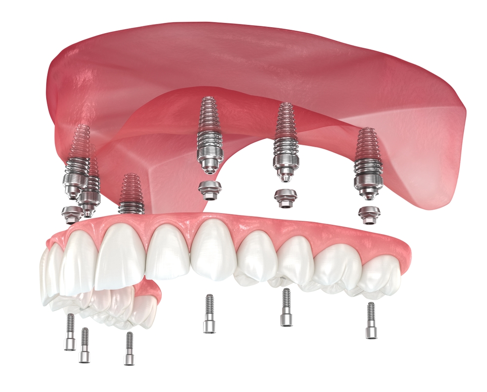 Gnathos Dental | Premium Dental Care in Hyderabad